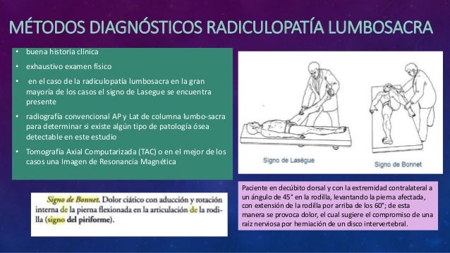 Radiculopatias