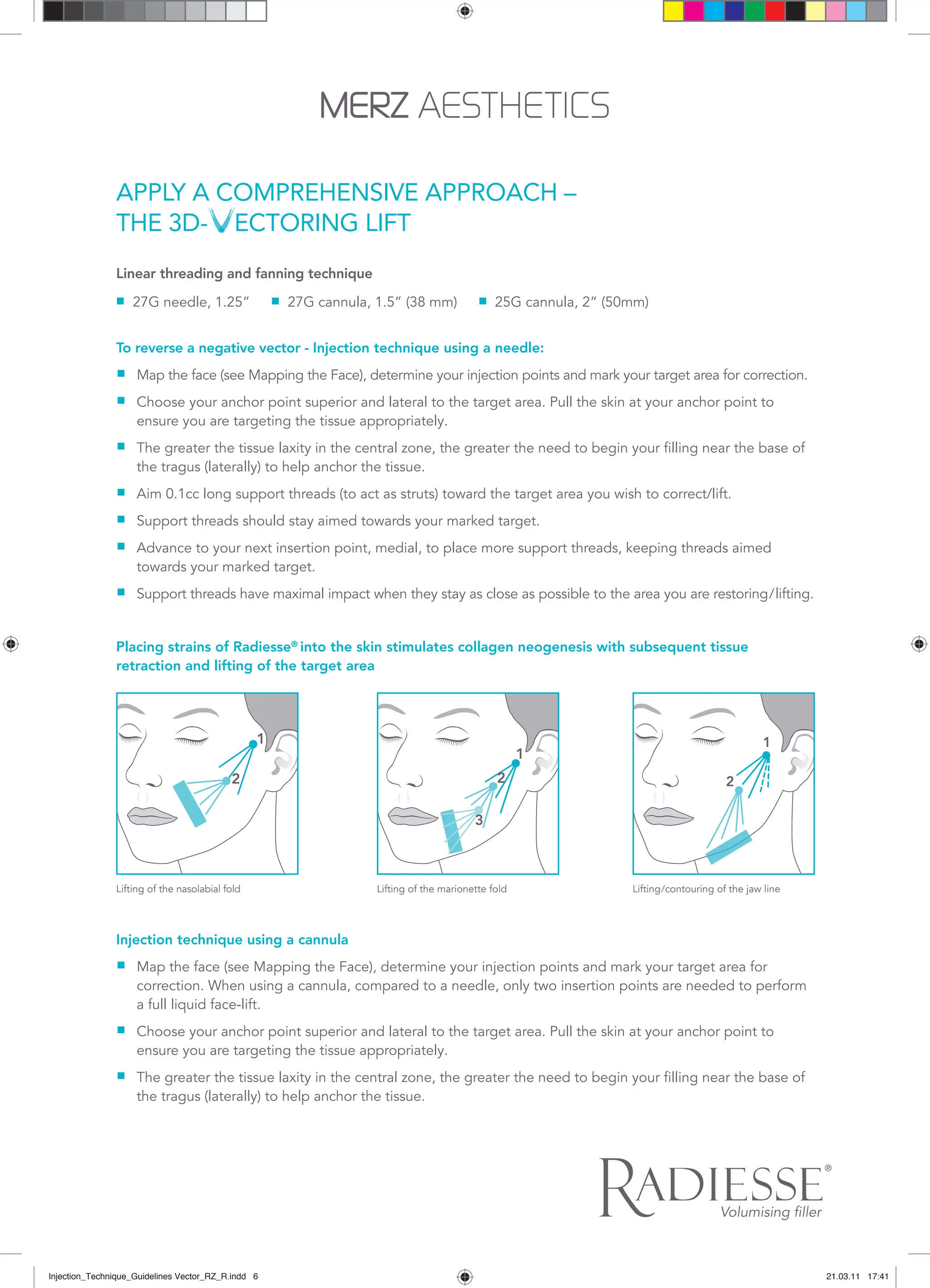 Radiesse Injection Vectoring | PDF