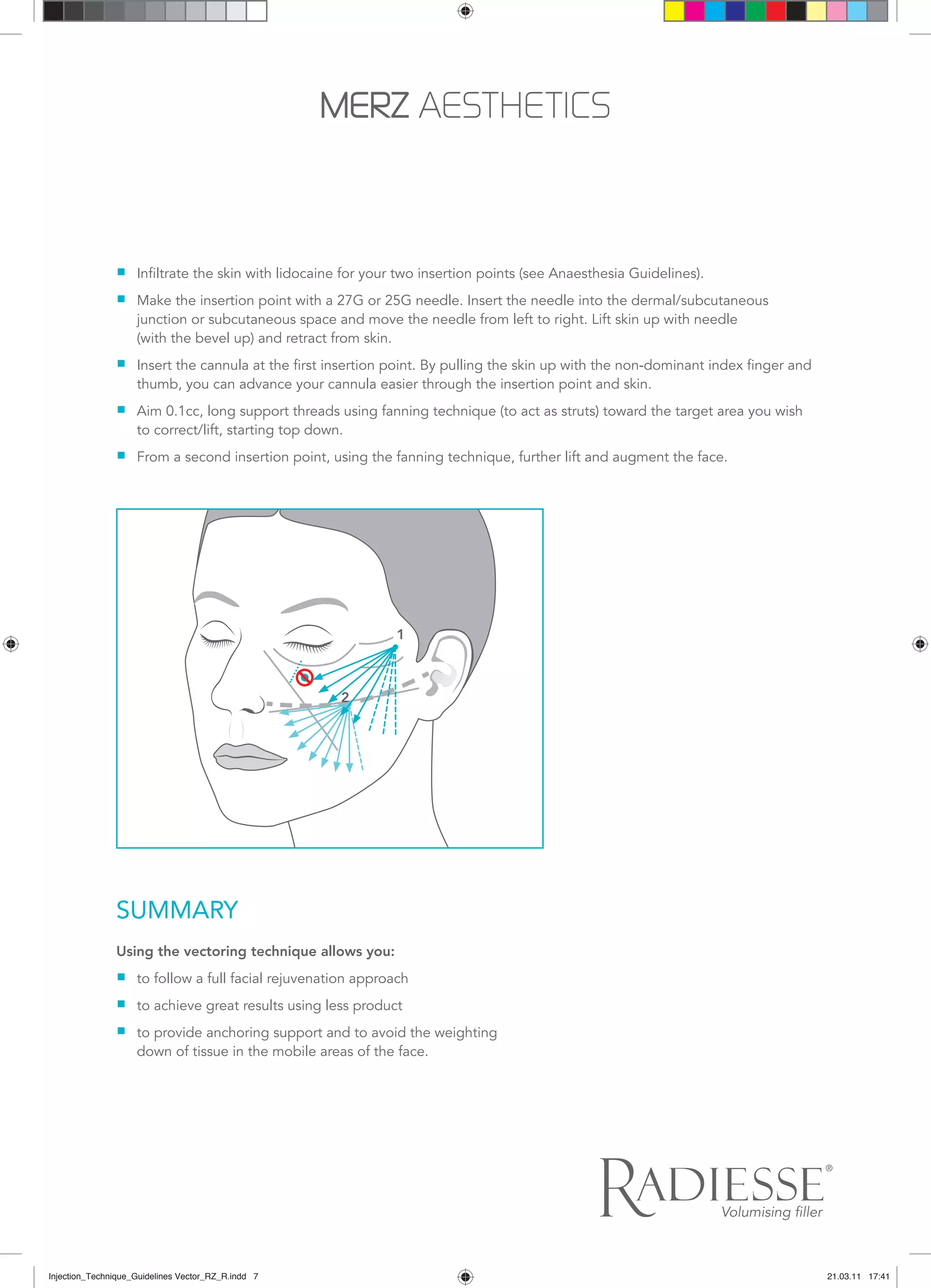 Radiesse Injection Vectoring | PDF