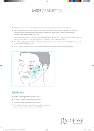 Radiesse Injection Vectoring | PDF