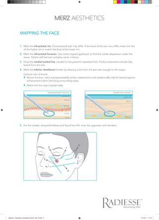 Radiesse Injection Vectoring | PDF