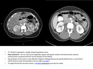 radilogical imaging in common kidney pathologies.pptx