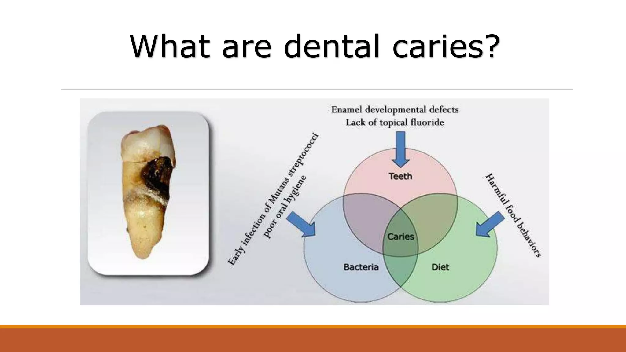 radiographic of interpretation of dental caries | PPTX