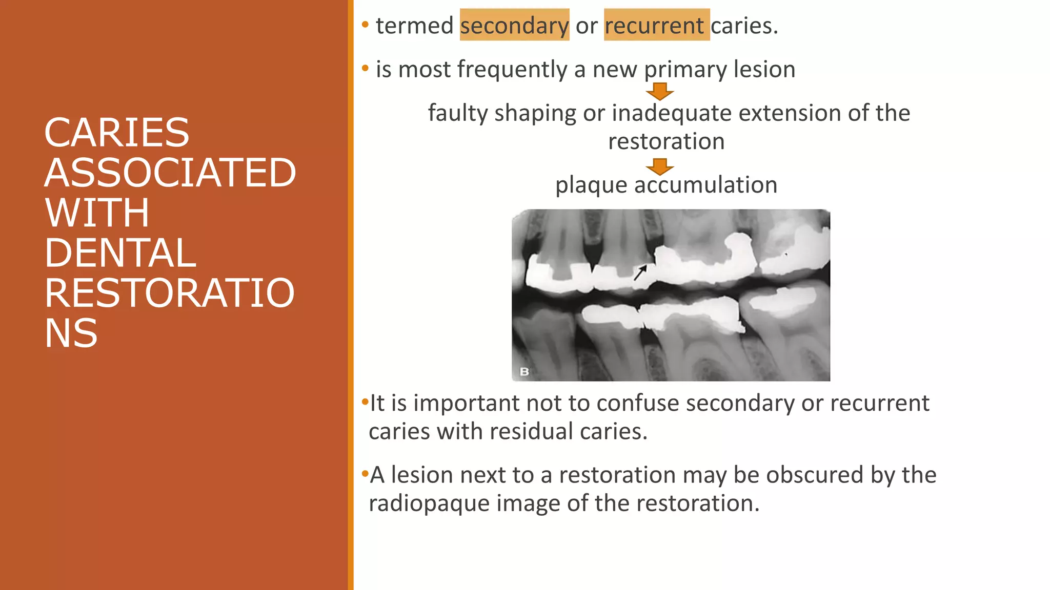 radiographic of interpretation of dental caries | PPTX