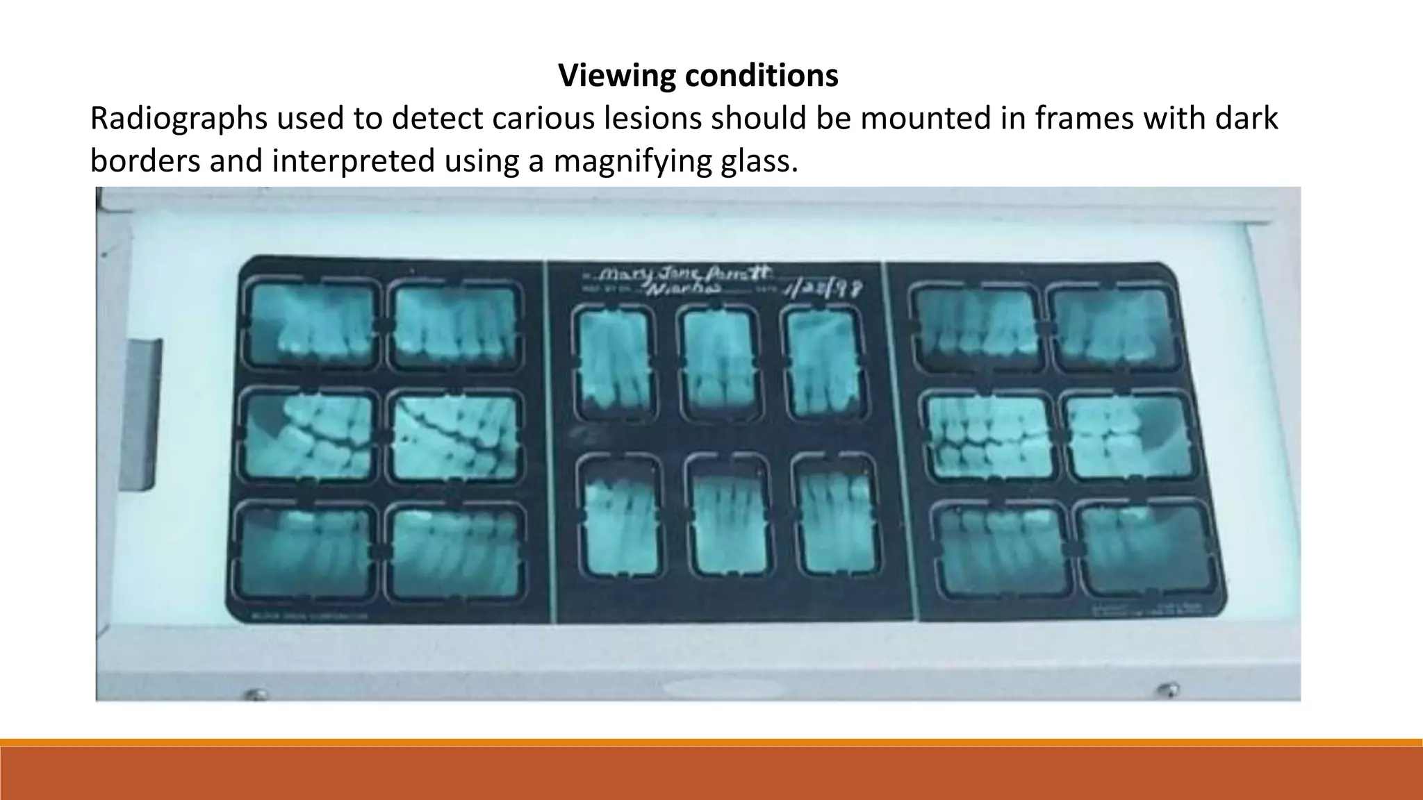 radiographic of interpretation of dental caries | PPTX