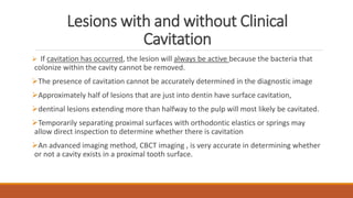 radiographic of interpretation of dental caries | PPTX