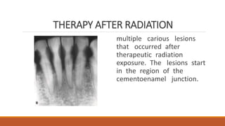 radiographic of interpretation of dental caries | PPTX
