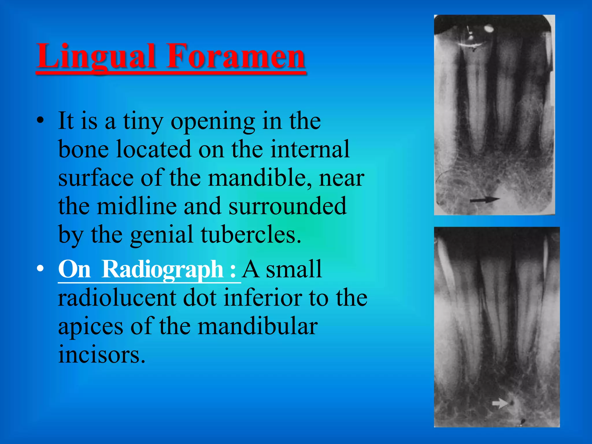 mandibular landmarks of radiograph | PPTX