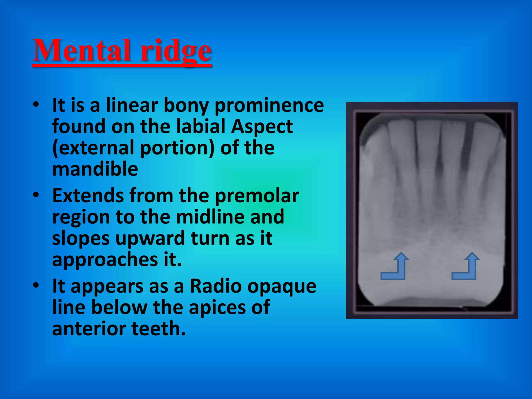 mandibular landmarks of radiograph | PPTX