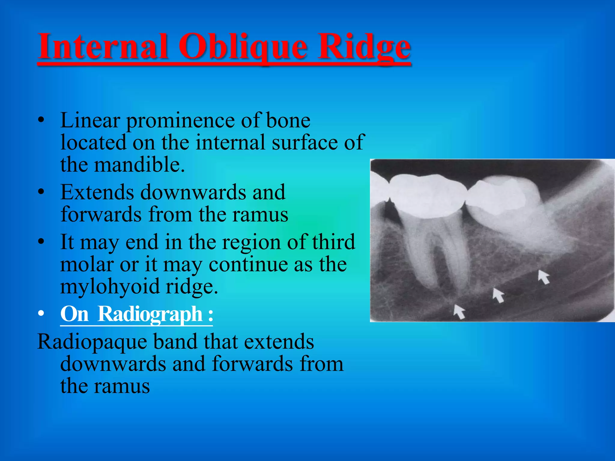mandibular landmarks of radiograph | PPTX | Dental Health | Diseases ...