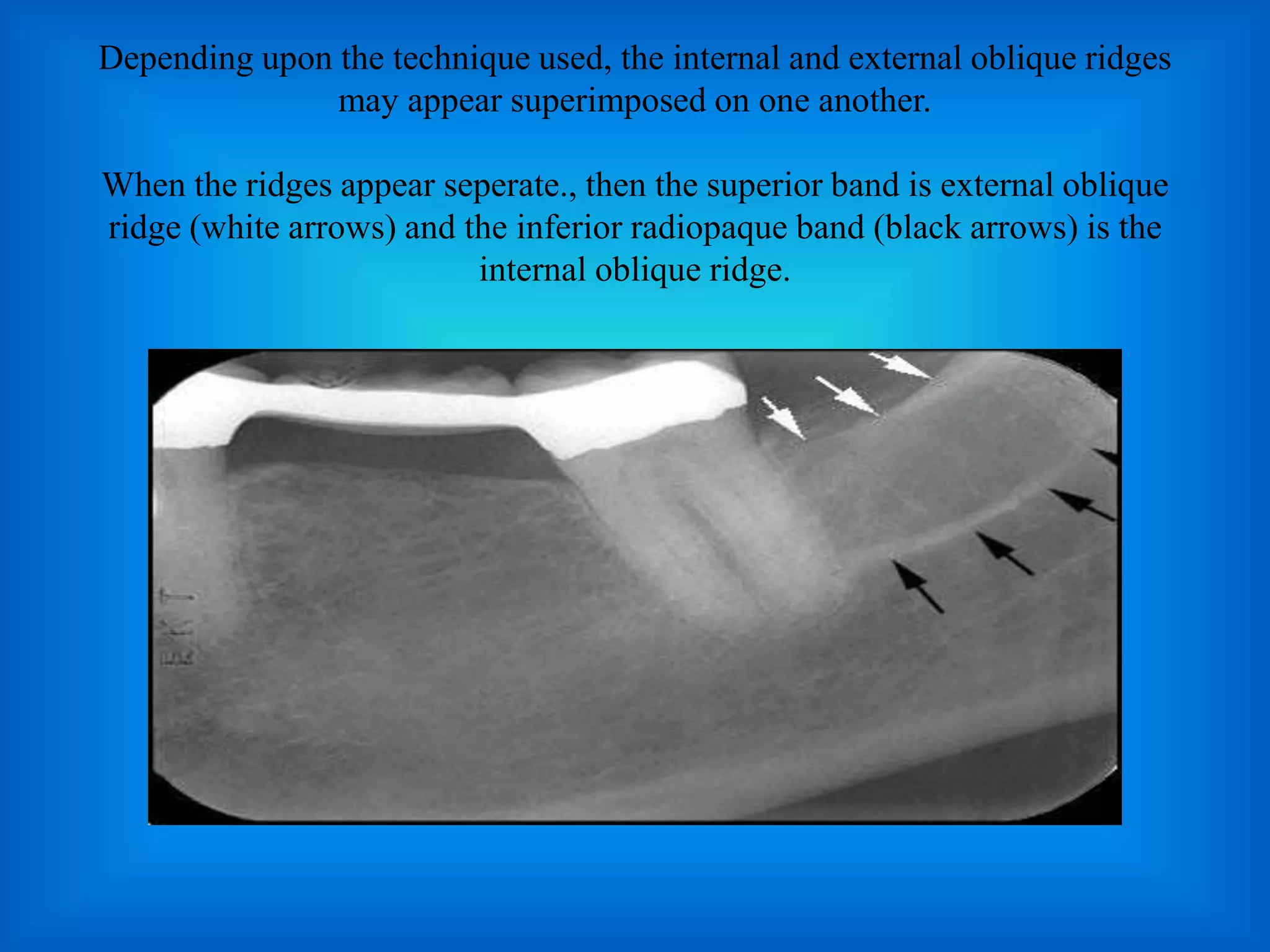 mandibular landmarks of radiograph | PPTX