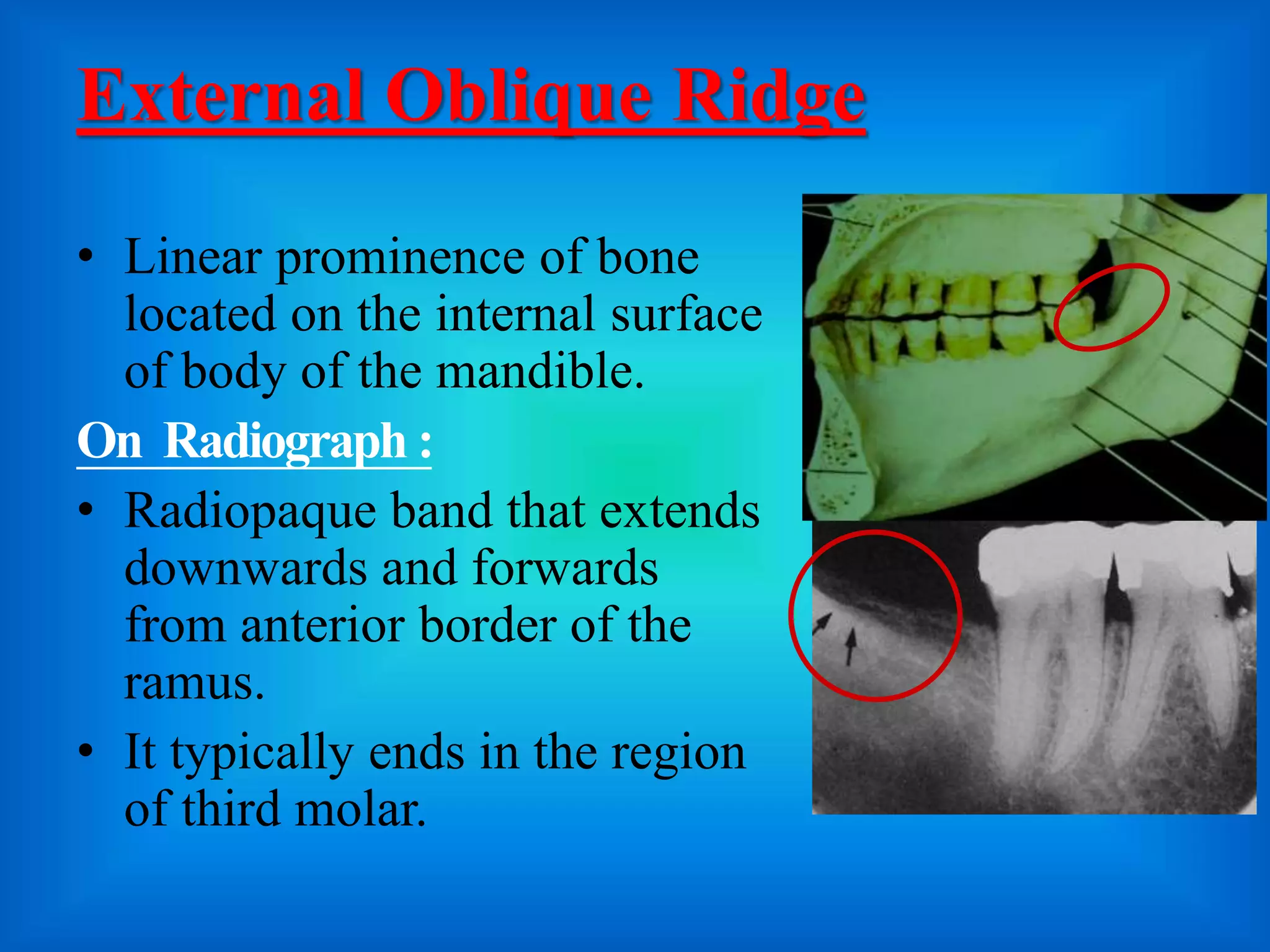 mandibular landmarks of radiograph | PPTX
