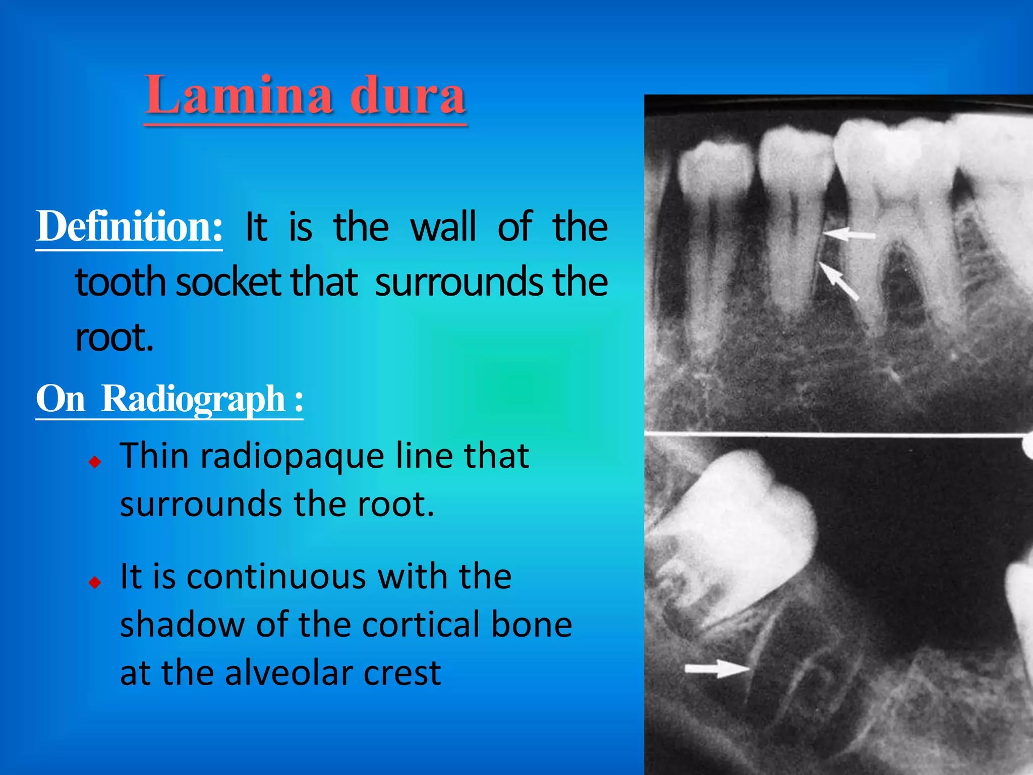 mandibular landmarks of radiograph | PPTX