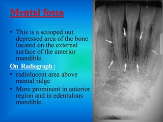 Mental Fossa Radiograph