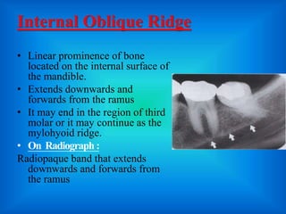 Internal Oblique Ridge Radiograph