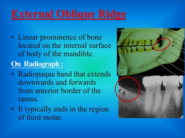 mandibular landmarks of radiograph | PPTX | Dental Health | Diseases ...