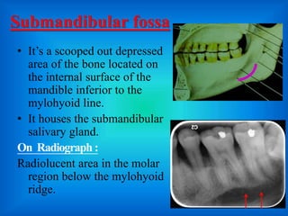 Submandibular Fossa Radiograph