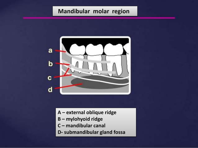 mandibular landmarks of radiograph | PPTX | Dental Health | Diseases ...