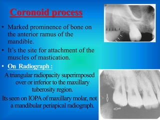 mandibular landmarks of radiograph | PPTX