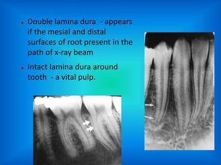 mandibular landmarks of radiograph | PPTX