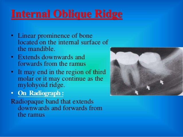 External Oblique Ridge