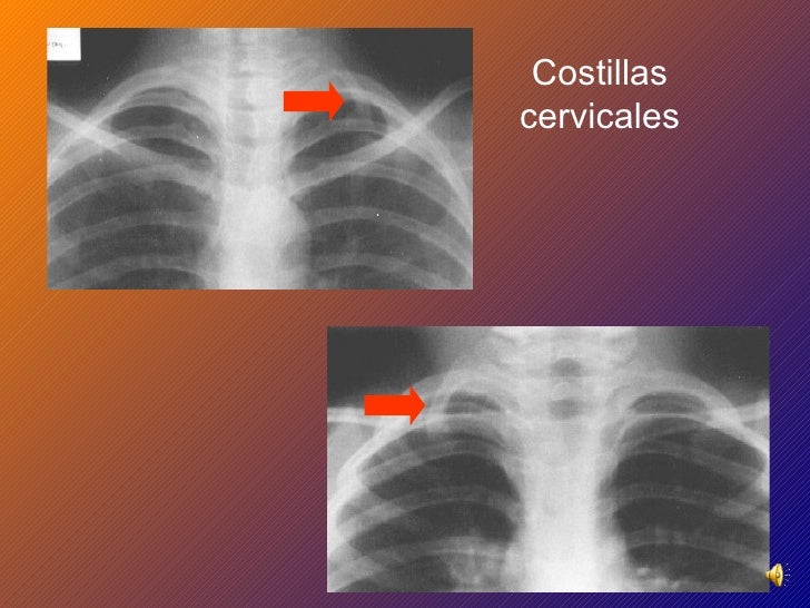 Radio Anatomia Torax Parte2