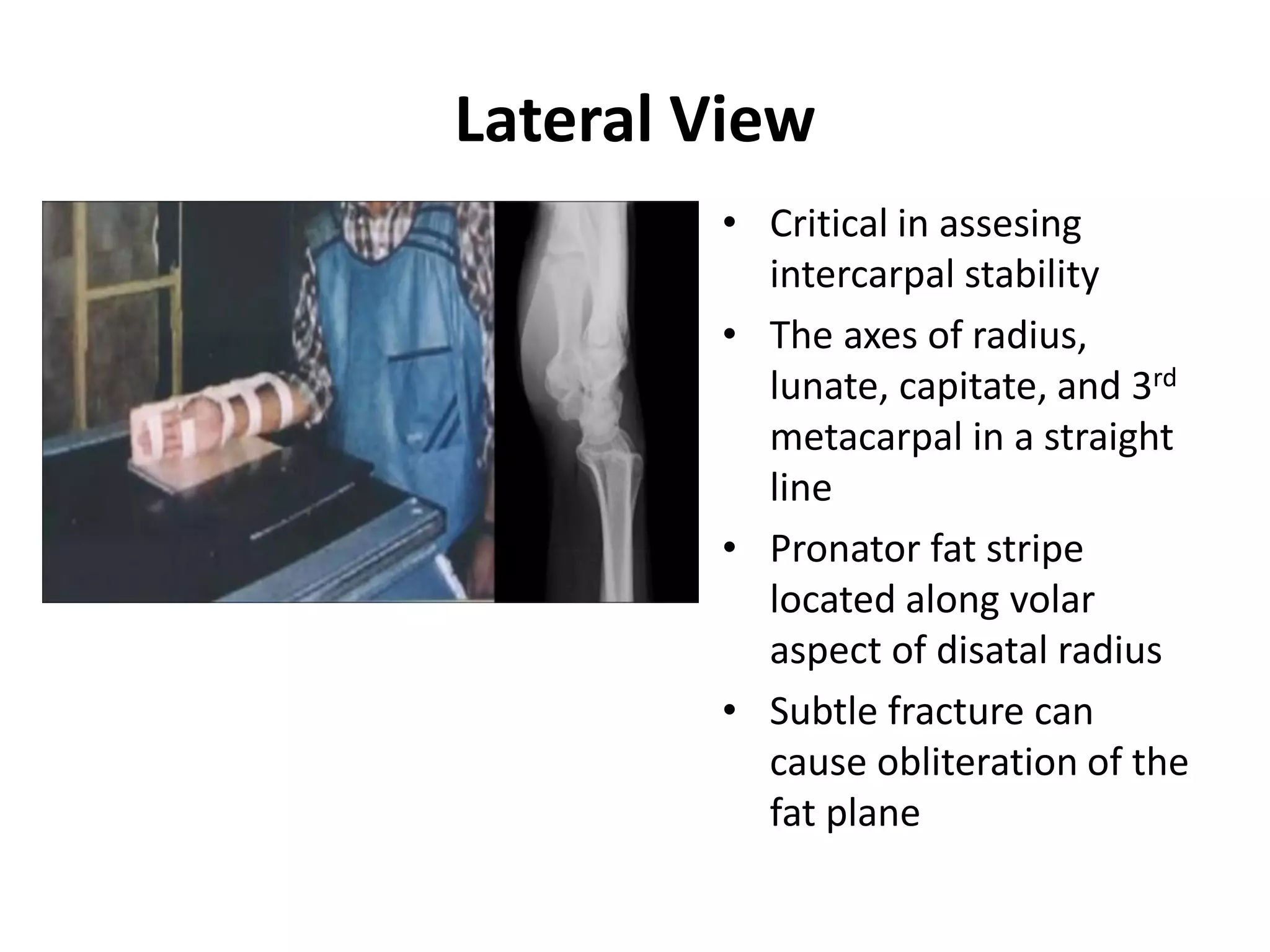 Radio-anatomy and Radio-pathology of hand and wrist.pdf