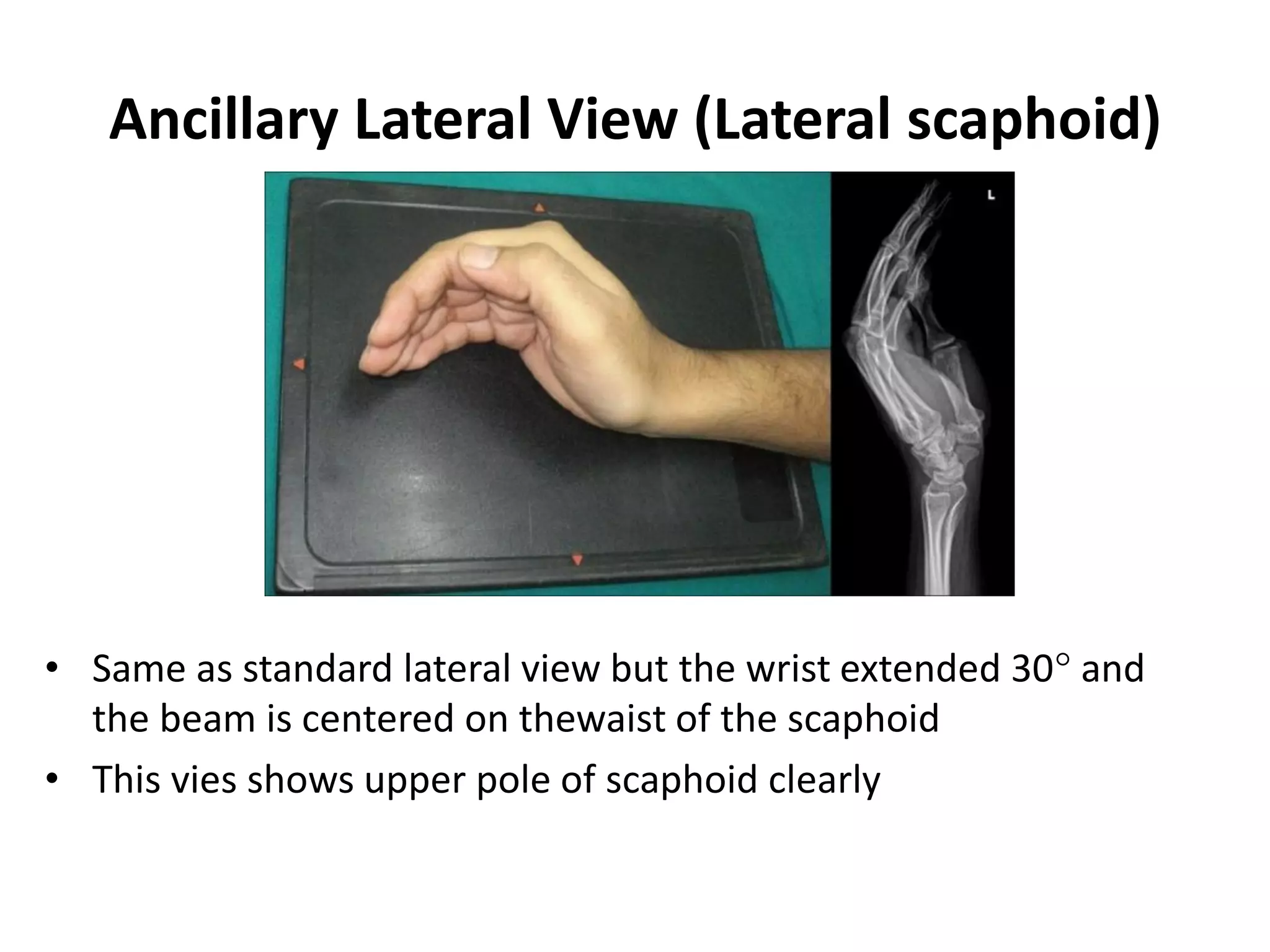 Radio-anatomy and Radio-pathology of hand and wrist.pdf