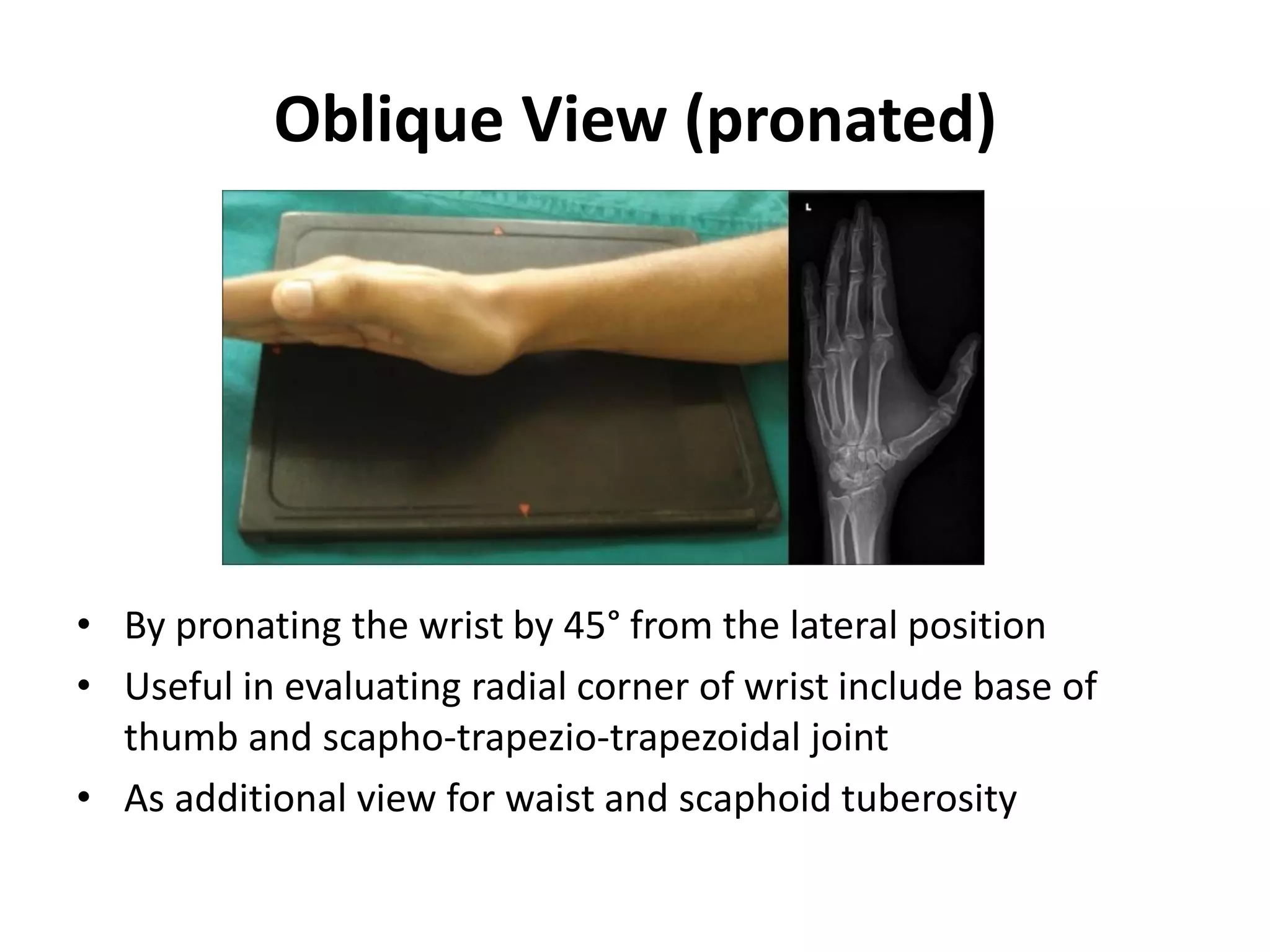 Radio-anatomy and Radio-pathology of hand and wrist.pdf
