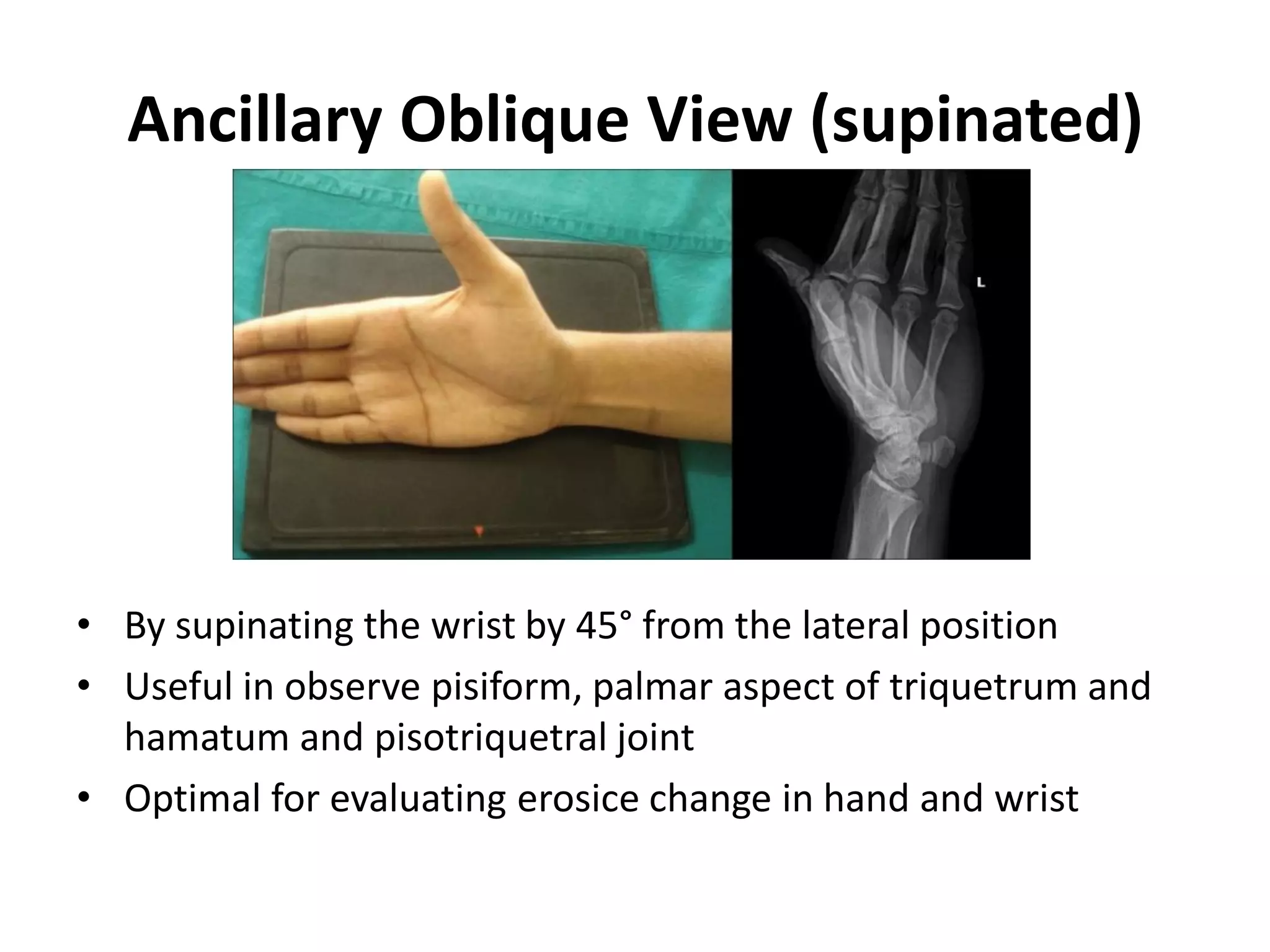 Radio-anatomy and Radio-pathology of hand and wrist.pdf