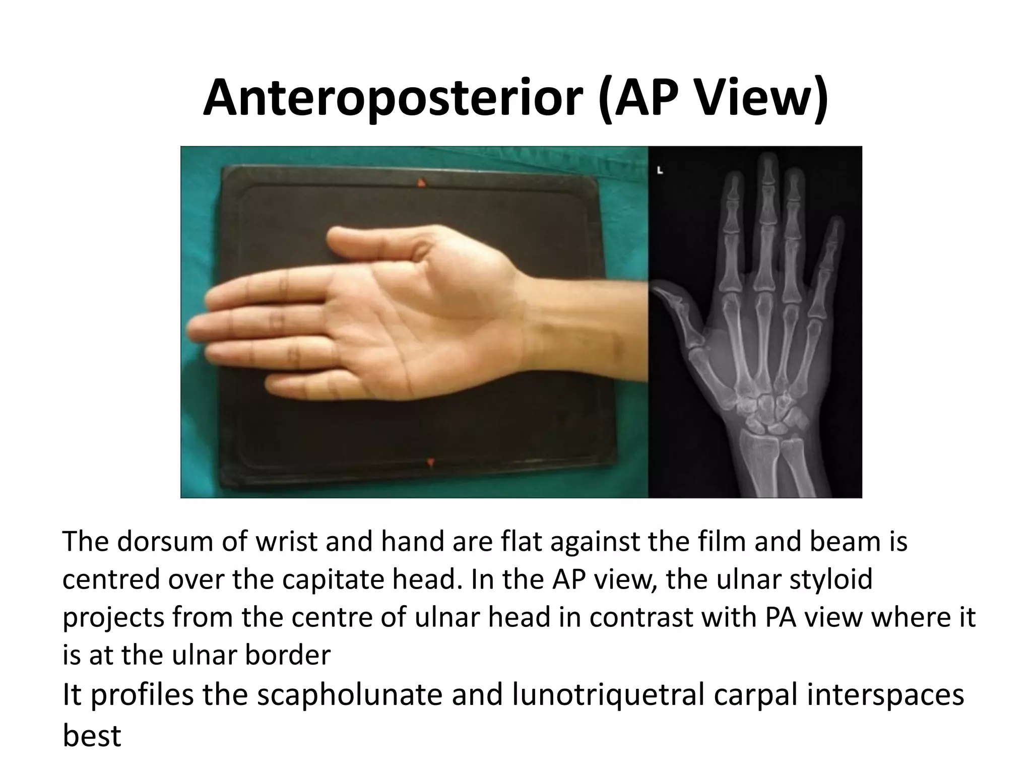 Radio-anatomy and Radio-pathology of hand and wrist.pdf