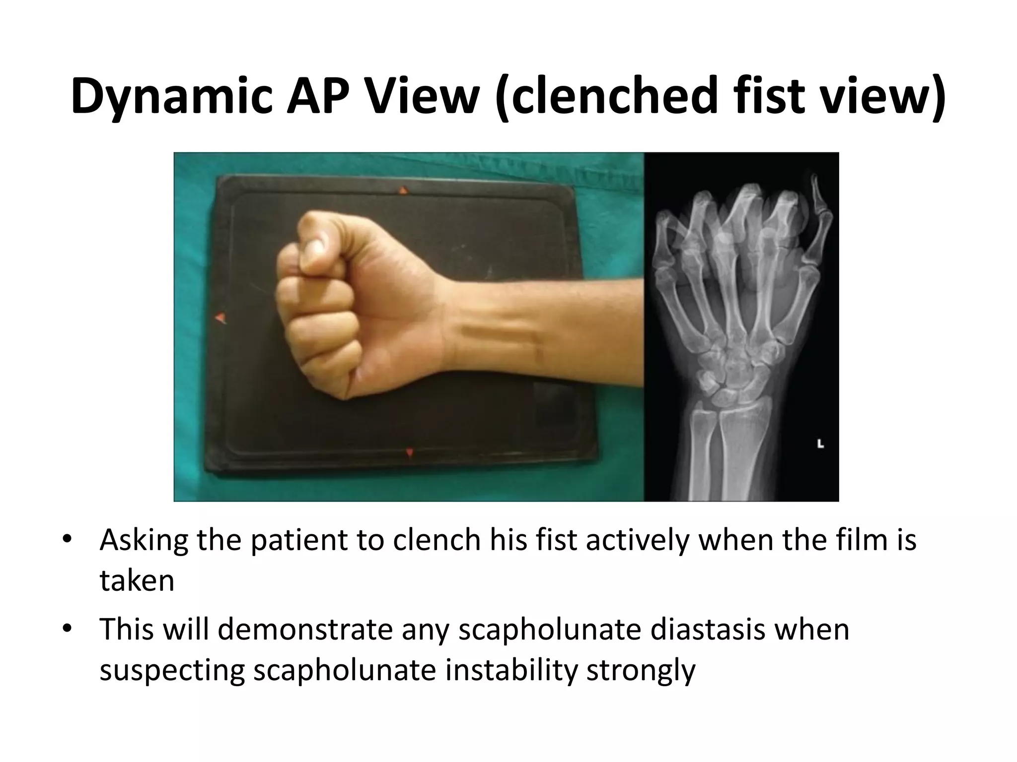 Radio-anatomy and Radio-pathology of hand and wrist.pdf