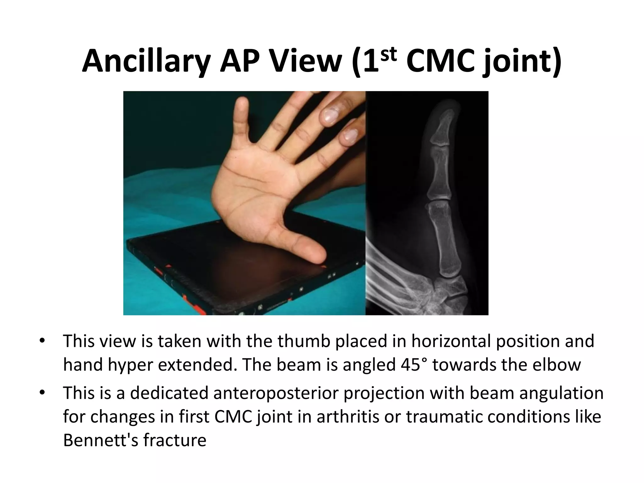 Radio-anatomy and Radio-pathology of hand and wrist.pdf
