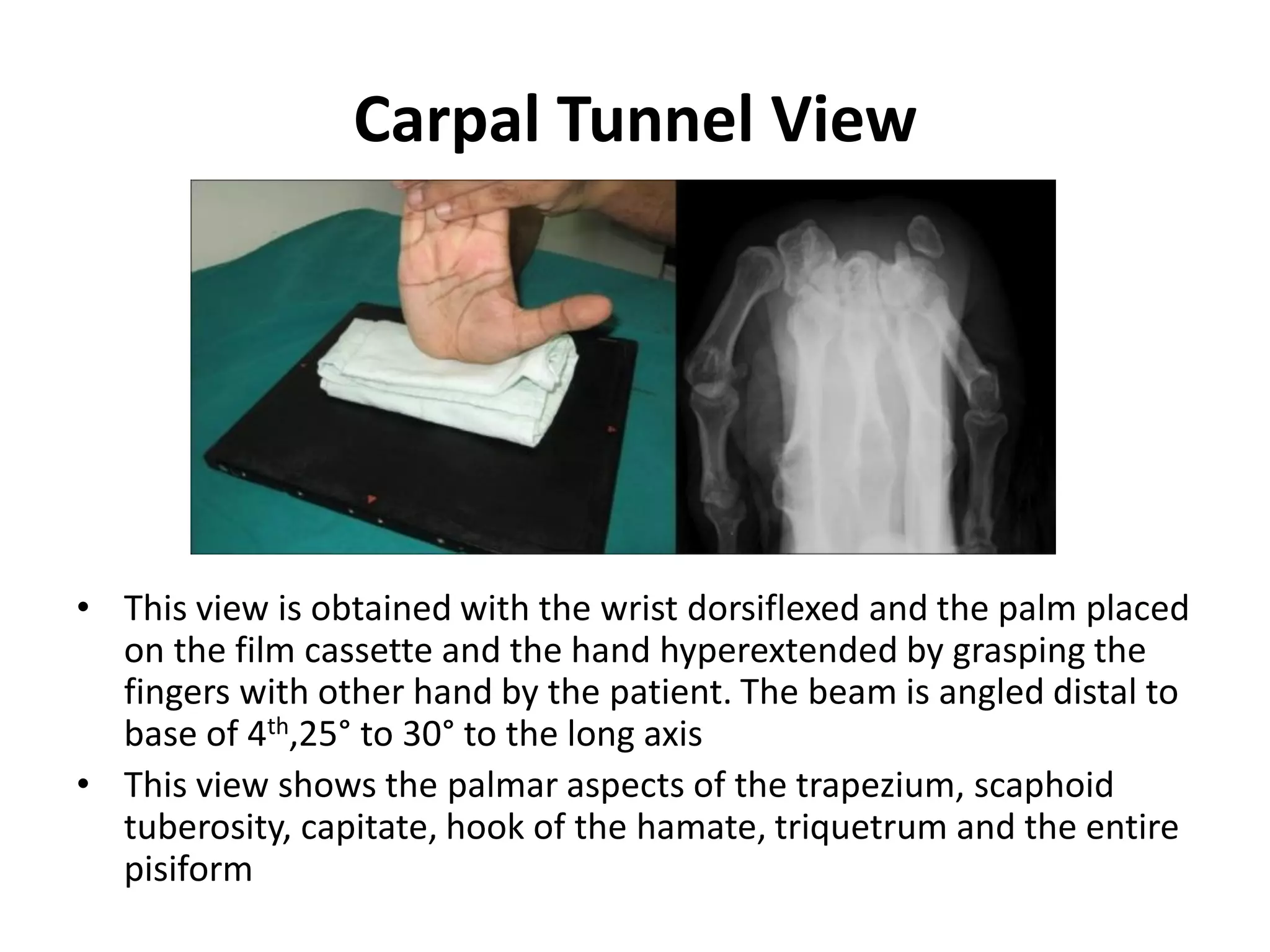 Radio-anatomy and Radio-pathology of hand and wrist.pdf