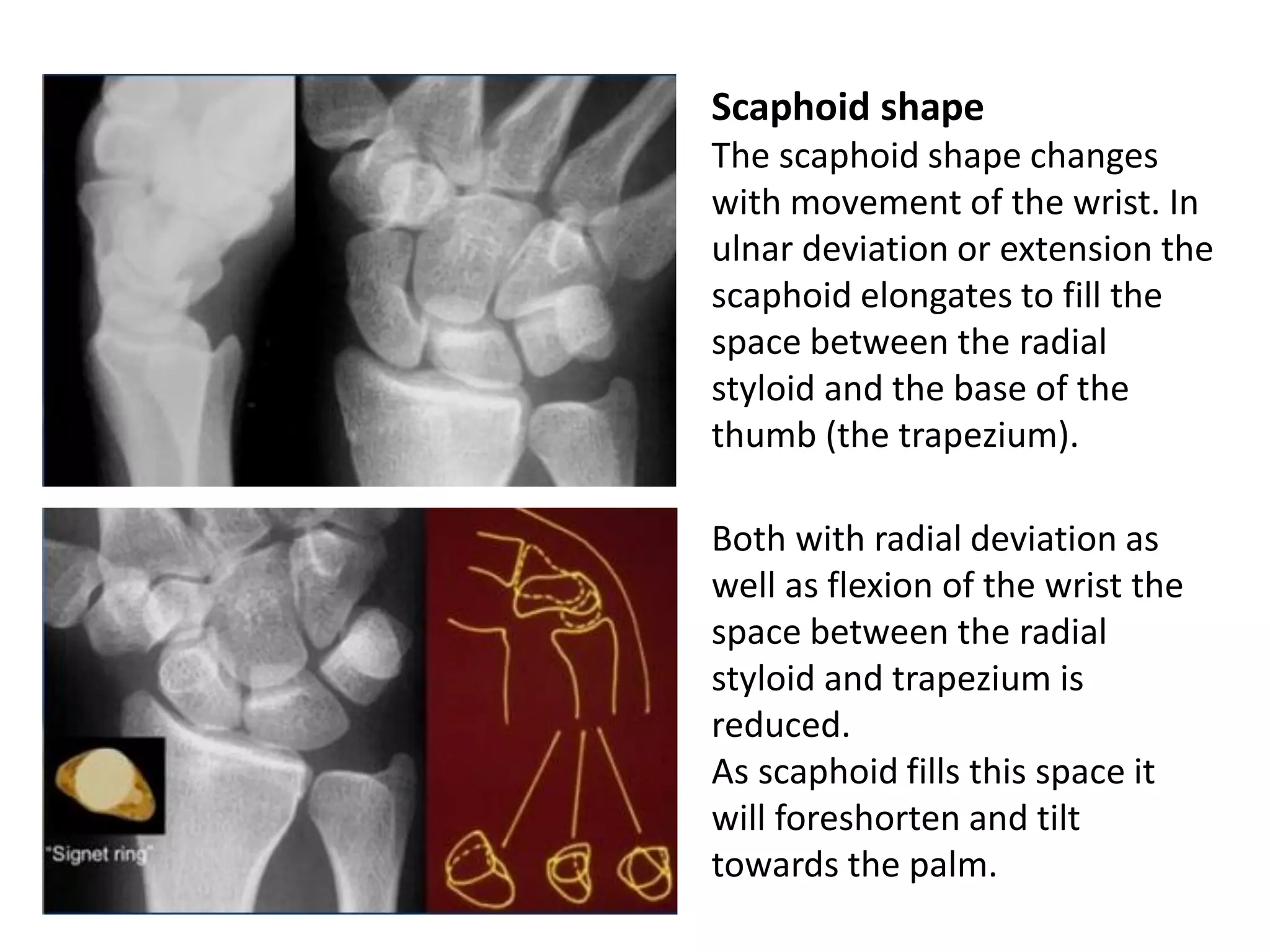 Radio-anatomy and Radio-pathology of hand and wrist.pdf
