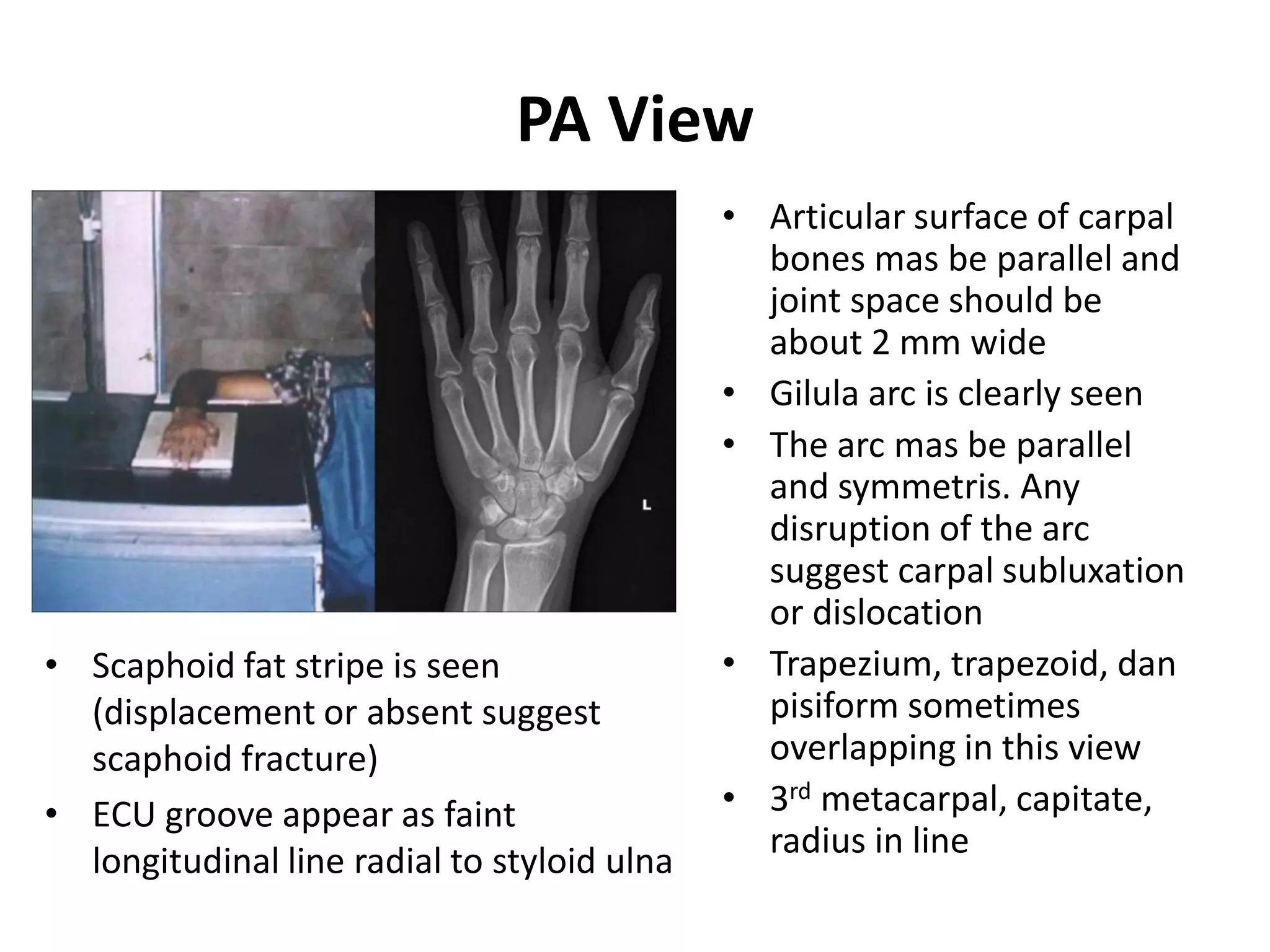 Radio-anatomy and Radio-pathology of hand and wrist.pdf
