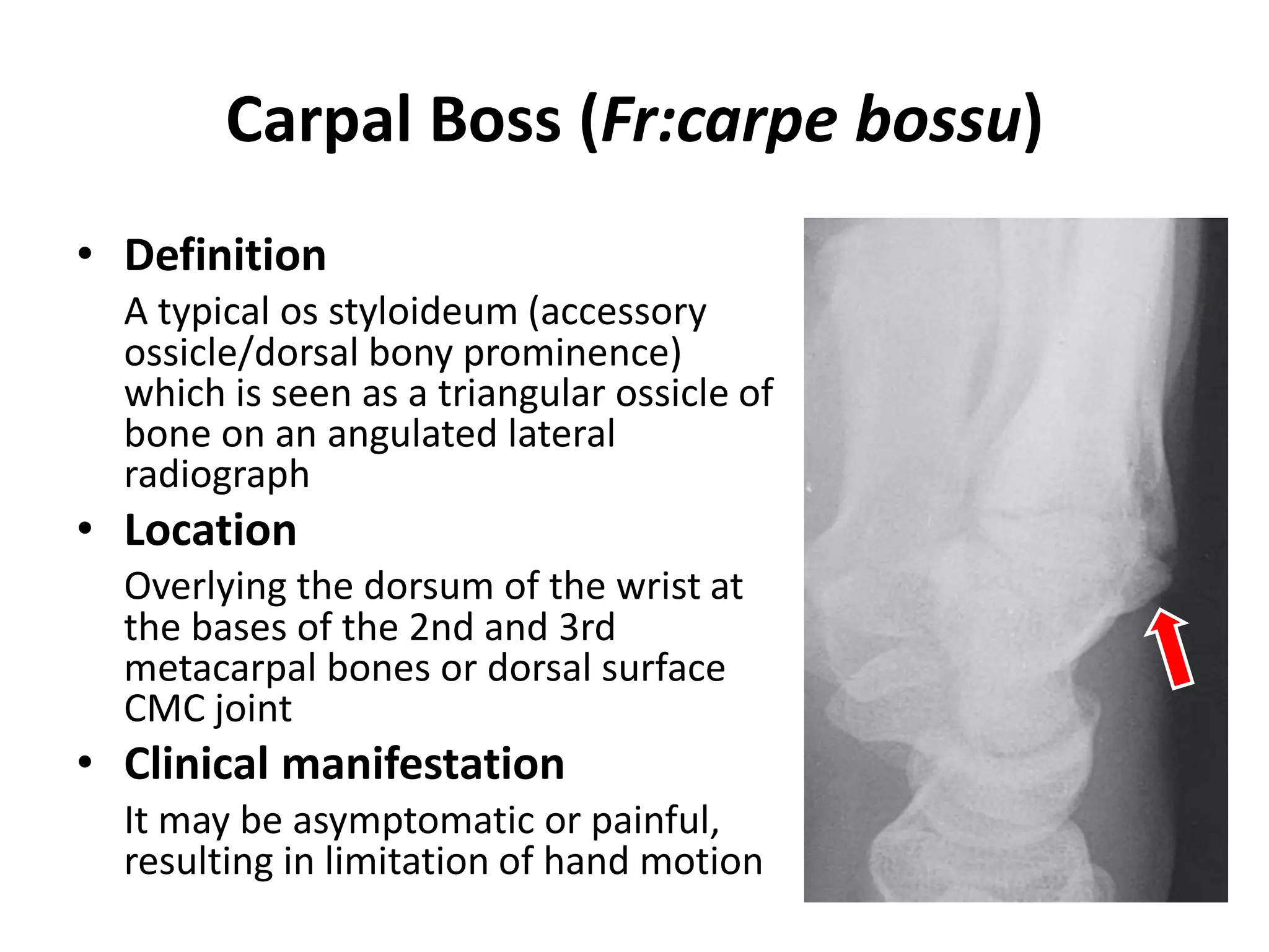 Radio-anatomy and Radio-pathology of hand and wrist.pdf
