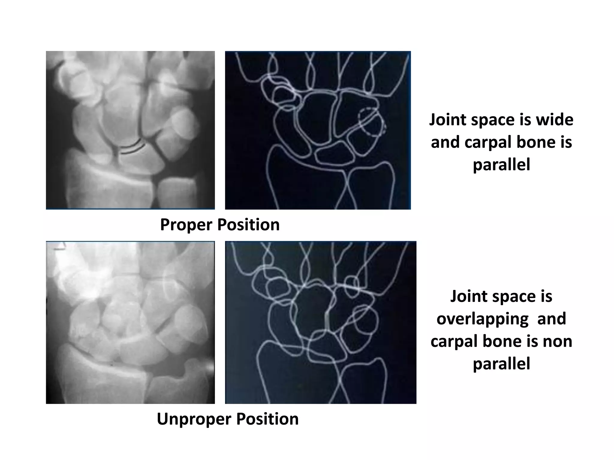 Radio-anatomy and Radio-pathology of hand and wrist.pdf