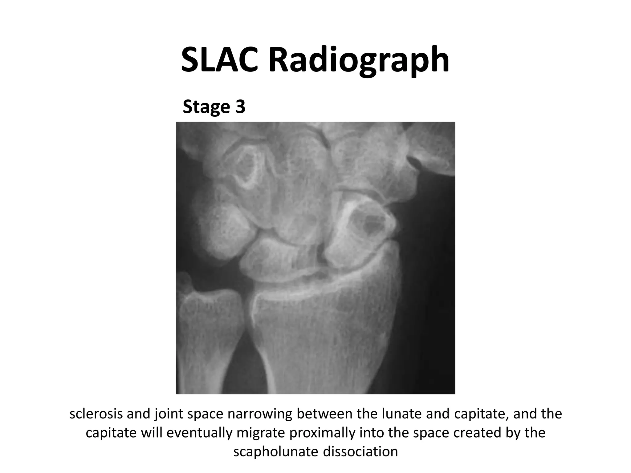 Radio-anatomy and Radio-pathology of hand and wrist.pdf