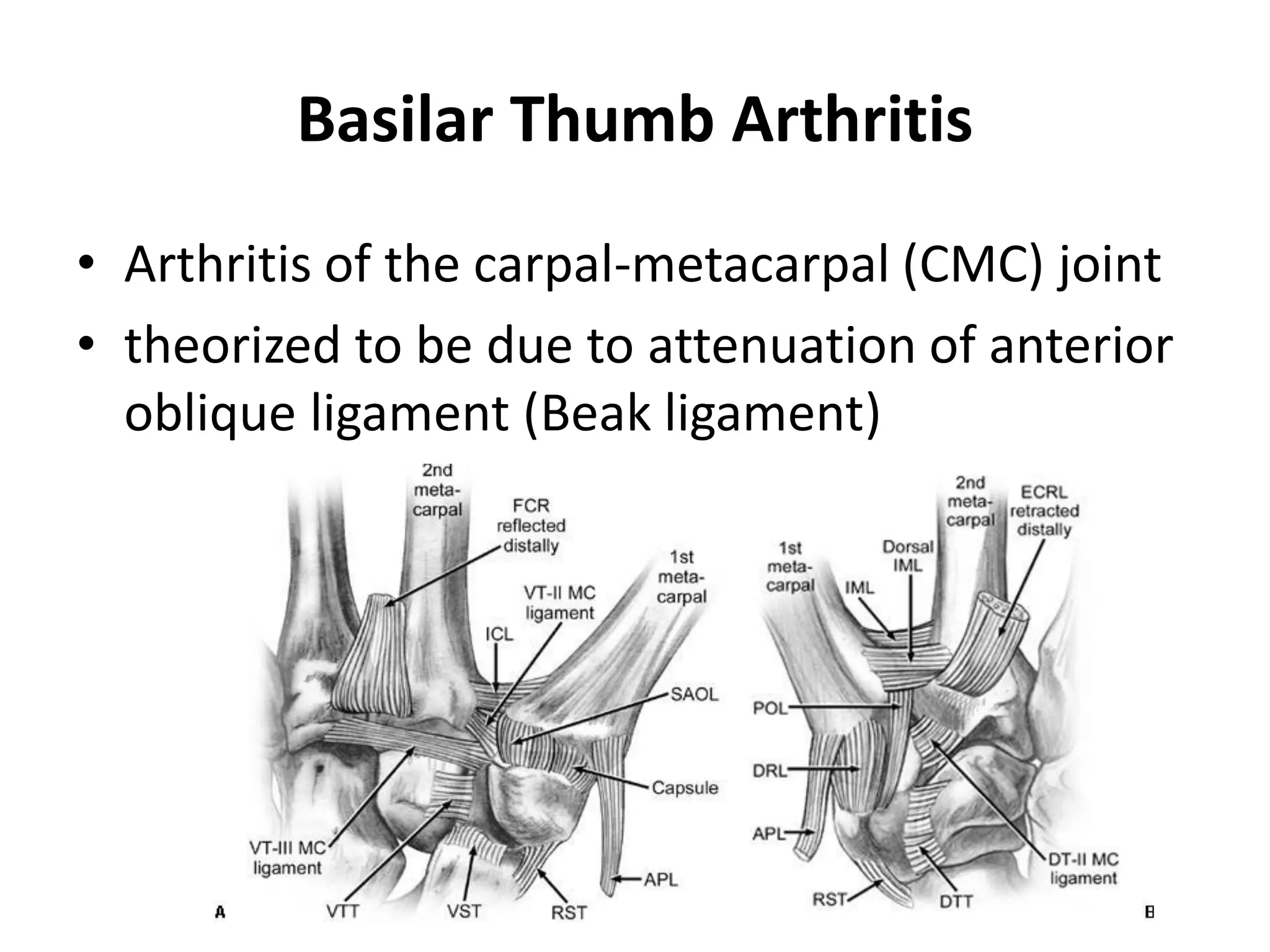 Radio-anatomy and Radio-pathology of hand and wrist.pdf