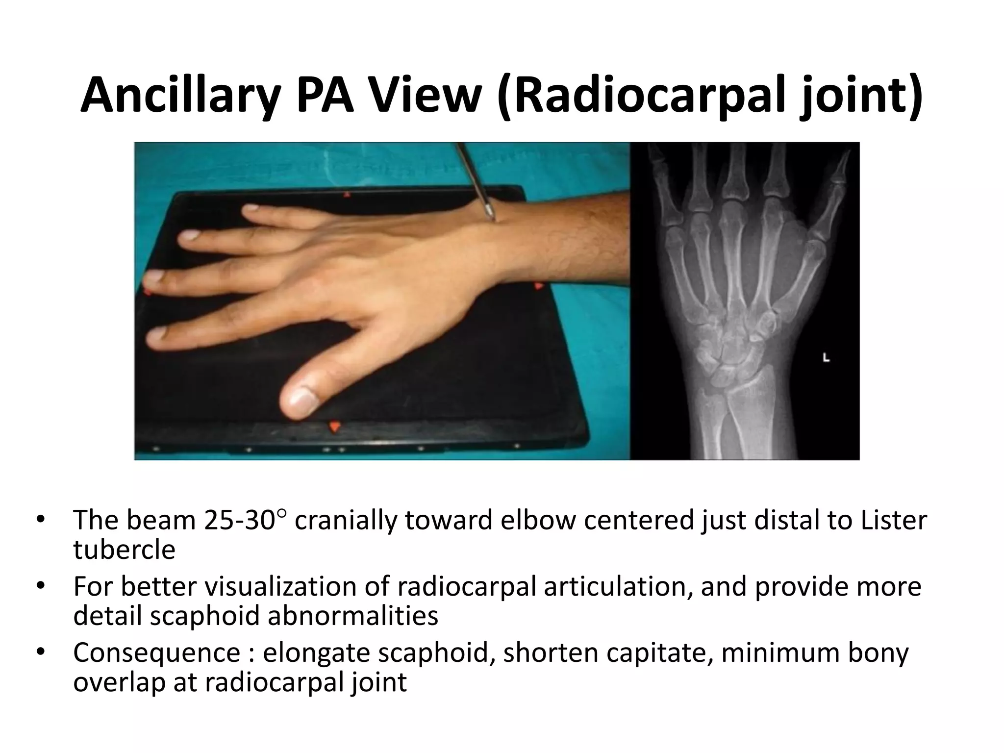 Radio-anatomy and Radio-pathology of hand and wrist.pdf