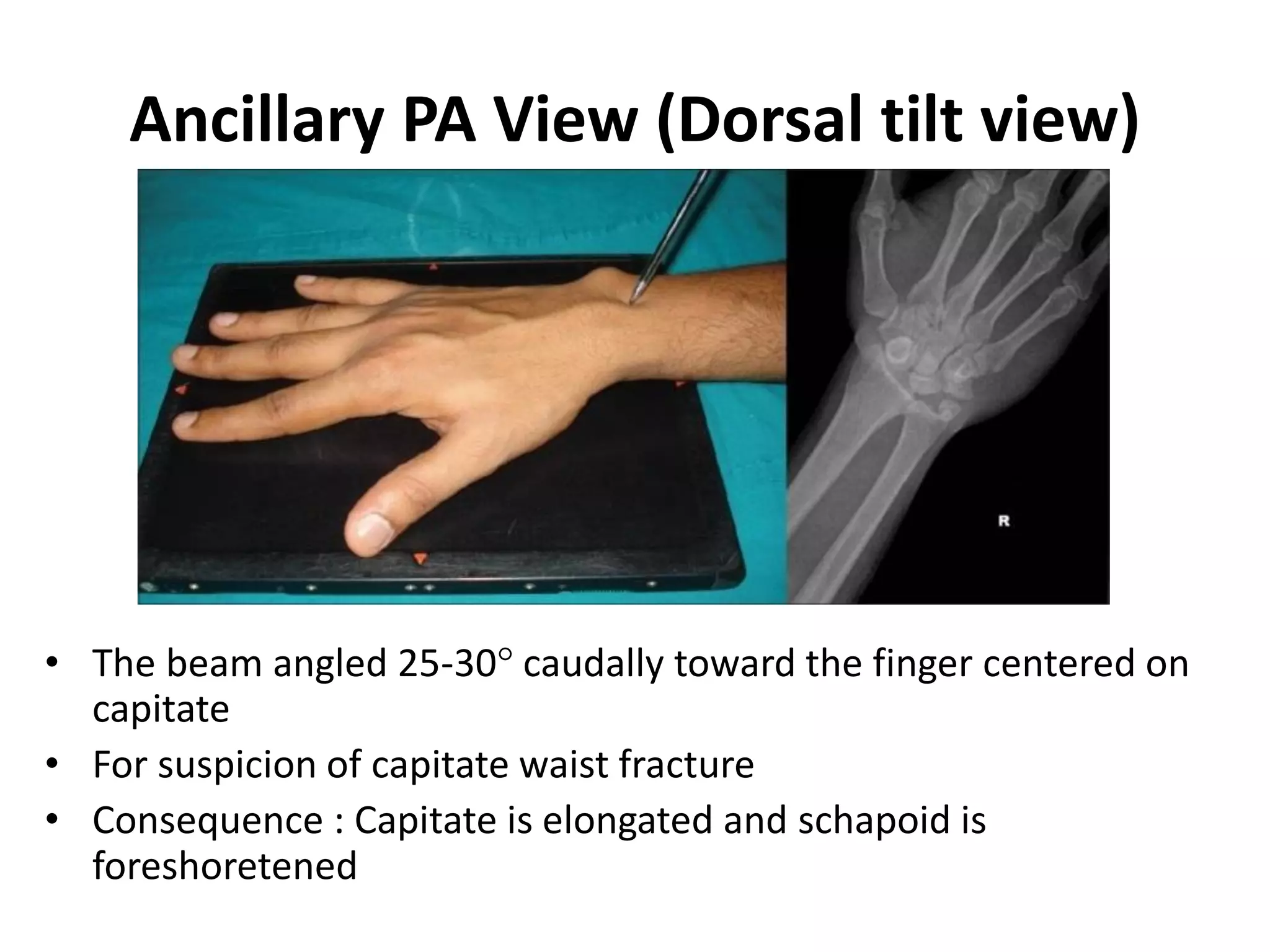 Radio-anatomy and Radio-pathology of hand and wrist.pdf
