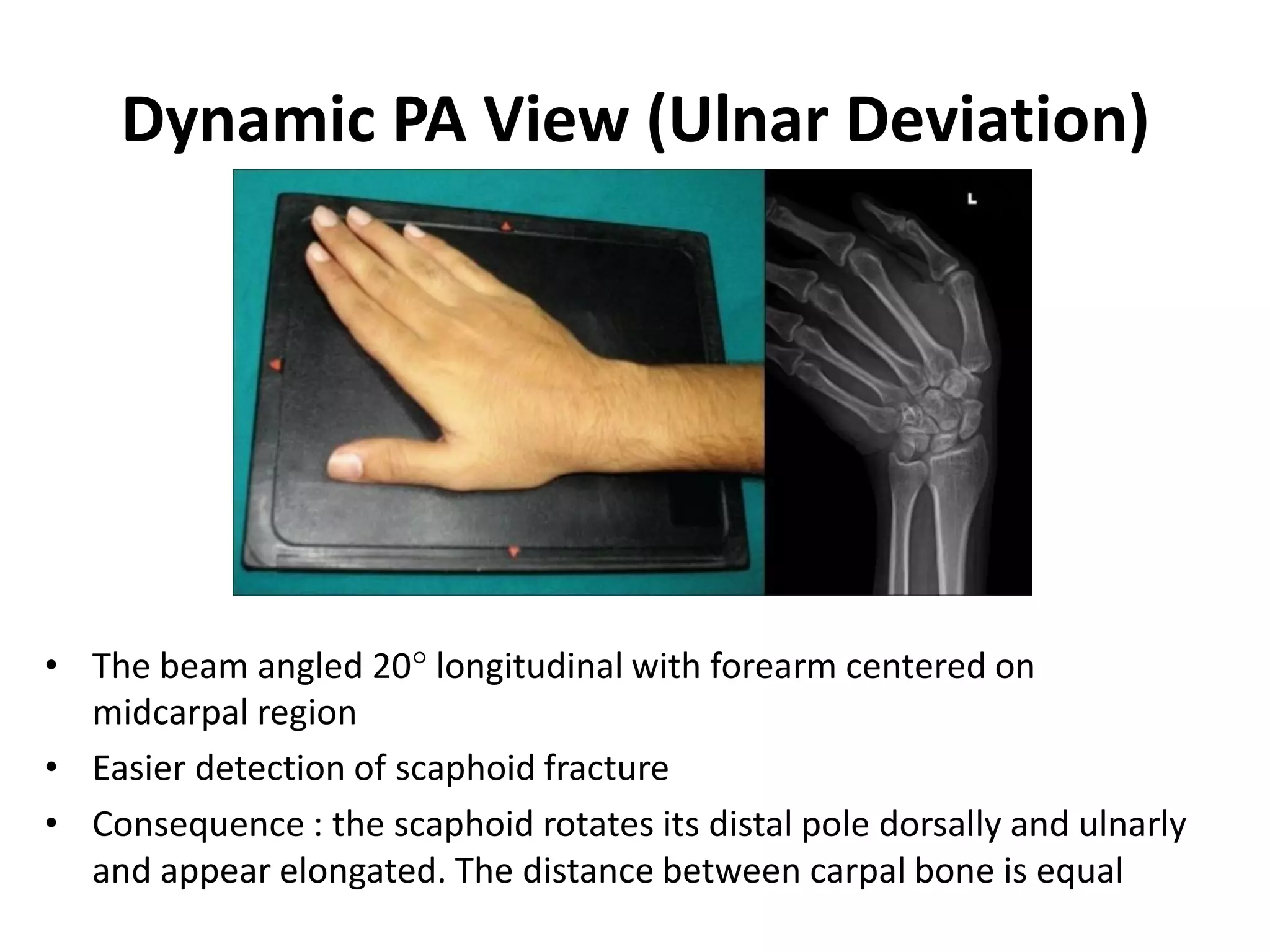 Radio-anatomy and Radio-pathology of hand and wrist.pdf