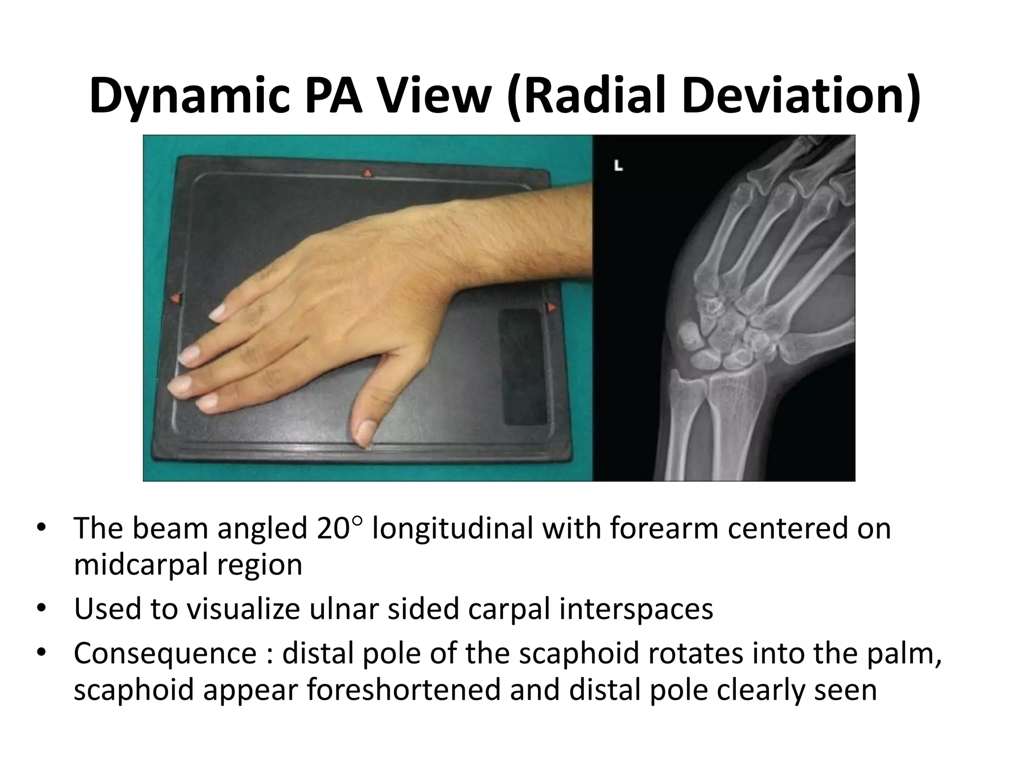 Radio-anatomy and Radio-pathology of hand and wrist.pdf