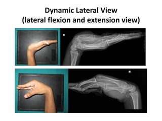 Radio-anatomy and Radio-pathology of hand and wrist.pdf