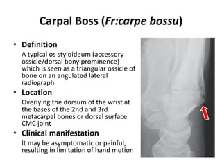 Radio-anatomy and Radio-pathology of hand and wrist.pdf