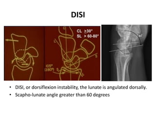 Radio-anatomy and Radio-pathology of hand and wrist.pdf