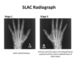 Radio-anatomy and Radio-pathology of hand and wrist.pdf