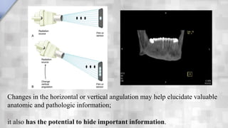 Radiographic findings of Endodontic lesions | PPSX | Dental Health ...