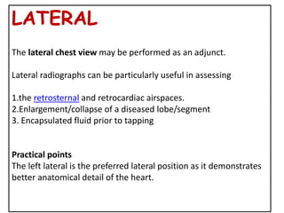 basics of chest xray | PPTX